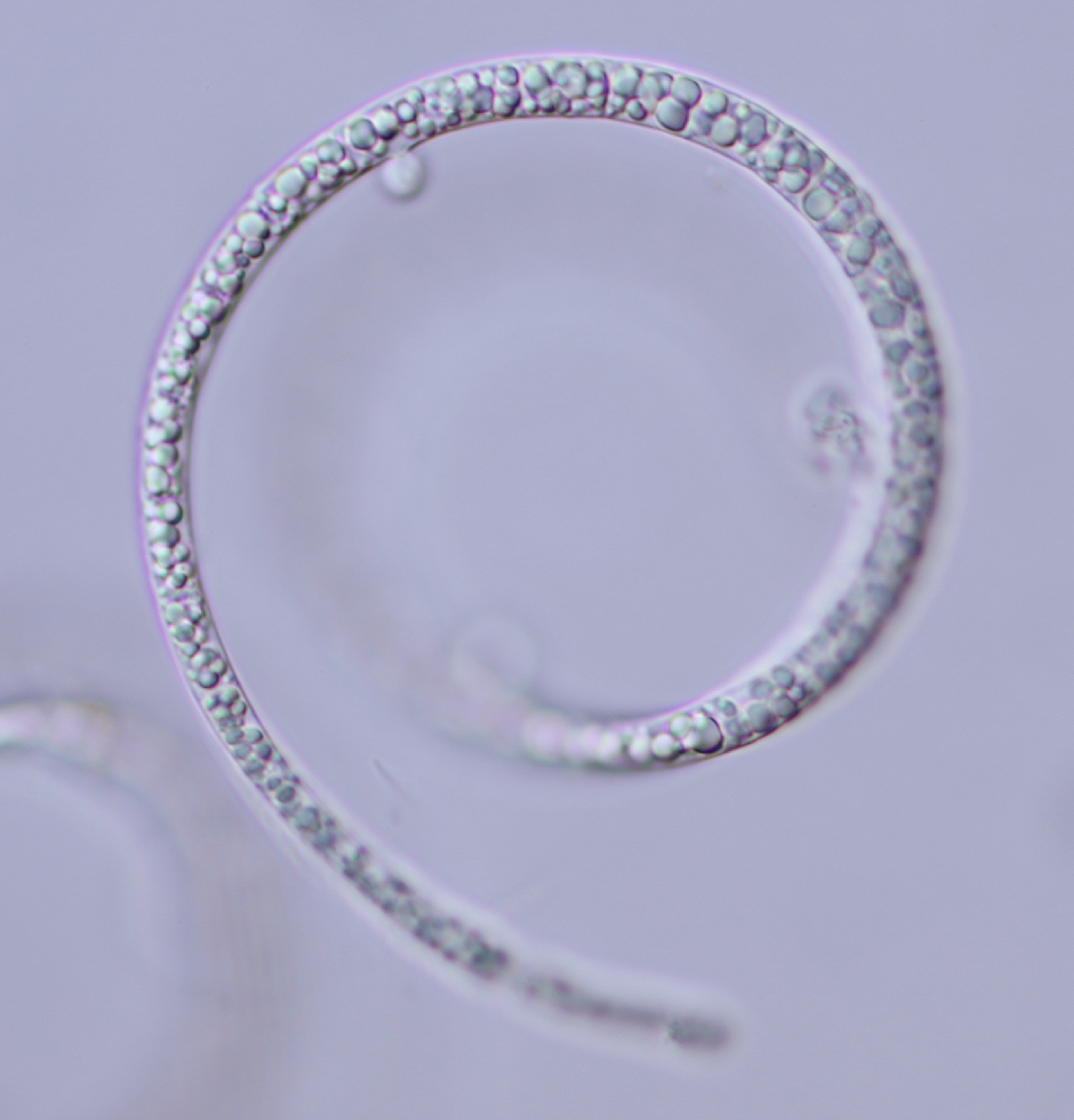 Australian freshwater and marine fungi